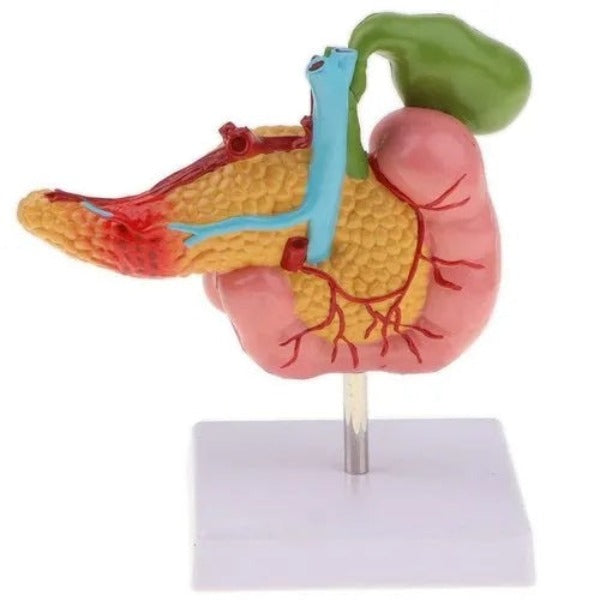 Diseased Pancreas, Spleen and Gall Bladder – MeddeyGo.com