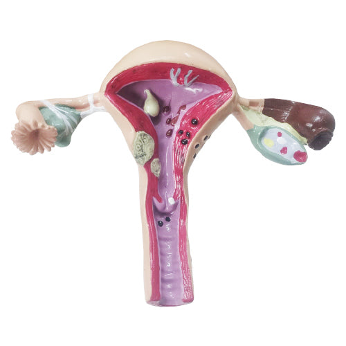 Uterus Anatomical Mode Delux Quality – MeddeyGo.com
