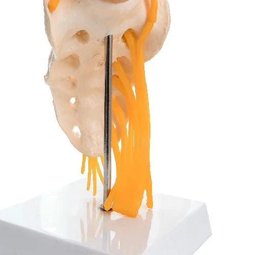 Lumbar Sacrum Spine Model with Herniated DIsc – MeddeyGo.com